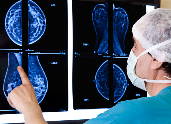 Lo que debes saber sobre las biopsias - La Opinión