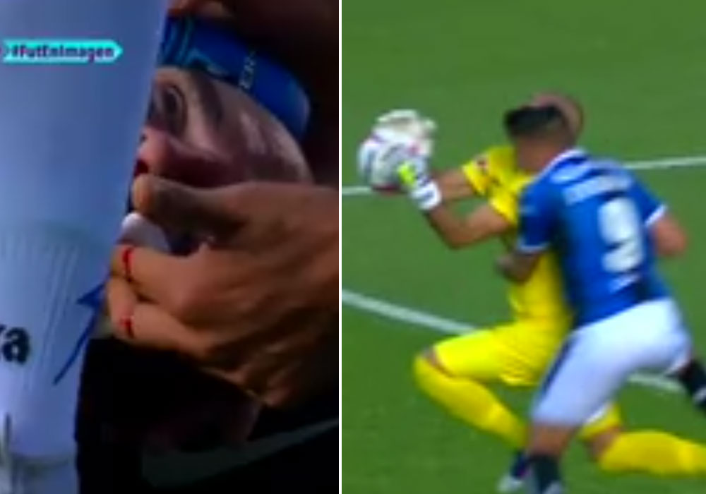 Portero de la Liga MX a punto de perder el ojo por terrible choque ...