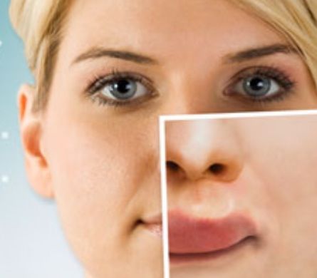 Mujer no puede respirar porque se le hinchan los labios - La Opinión