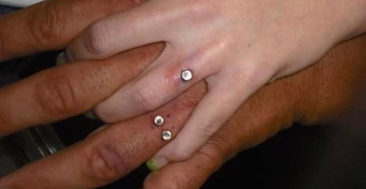 Diamantes incrustados en la piel, la nueva tendencia en lugar de los ...
