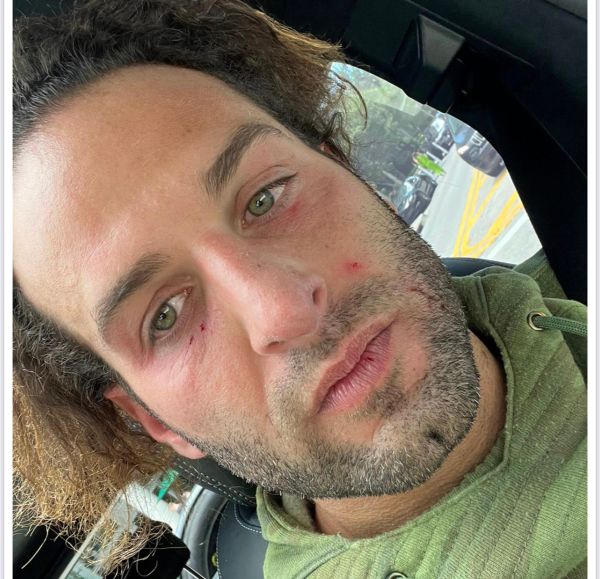 Miguel Mawad, ex de Gaby Espino, demandó a Génesis Aleska por violencia ...