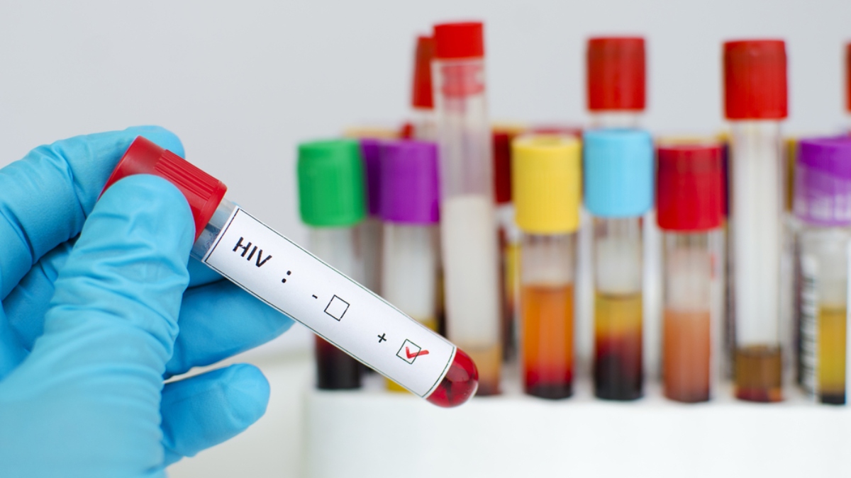Día Mundial del SIDA-HIV: por qué hoy los adolescentes tienen la mayor ...