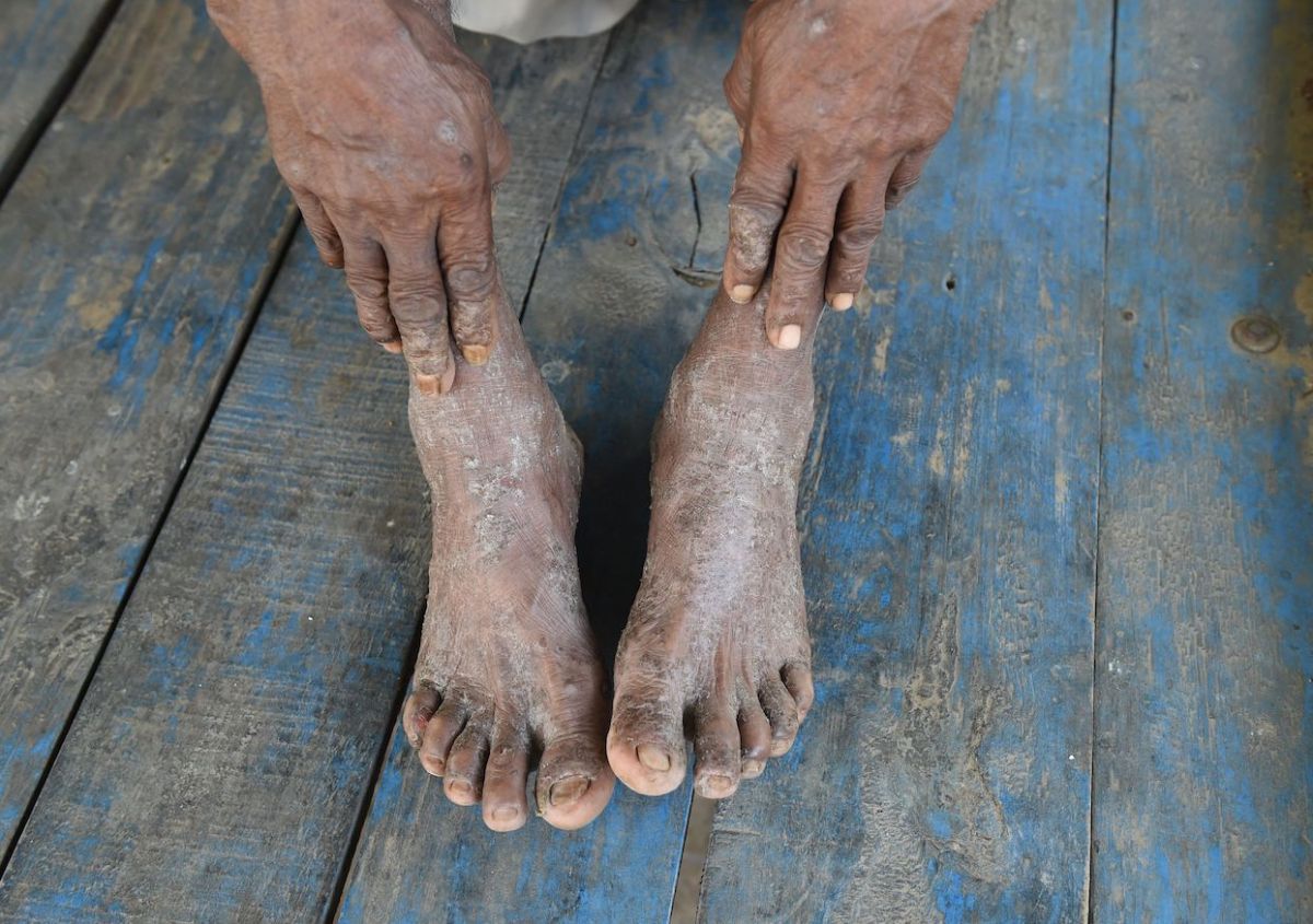 Hombre de Connecticut lleva más de 20 años caminando descalzo, esta es ...