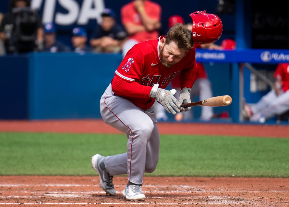 Pelotero de los Angels sufrió fracturas en el rostro tras recibir ...