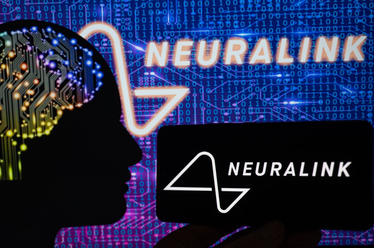 Neuralink implantó con éxito su segundo chip cerebral - La Opinión