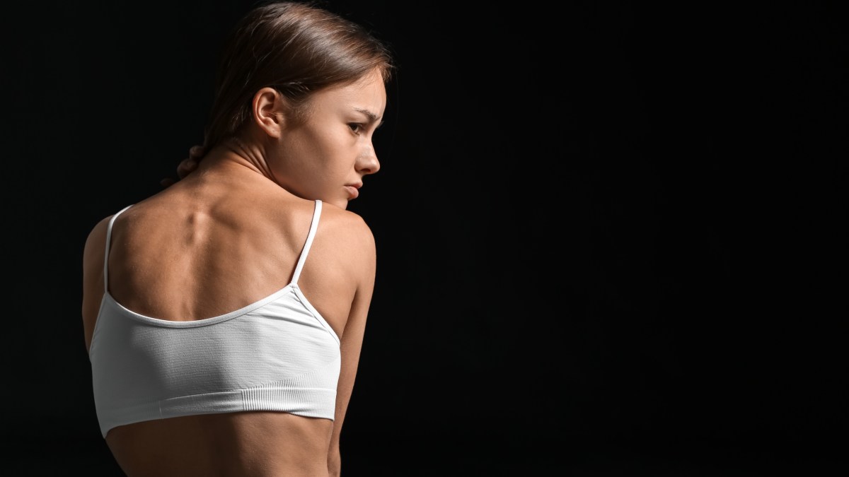 Nace una opción prometedora en el tratamiento de la anorexia nerviosa ...